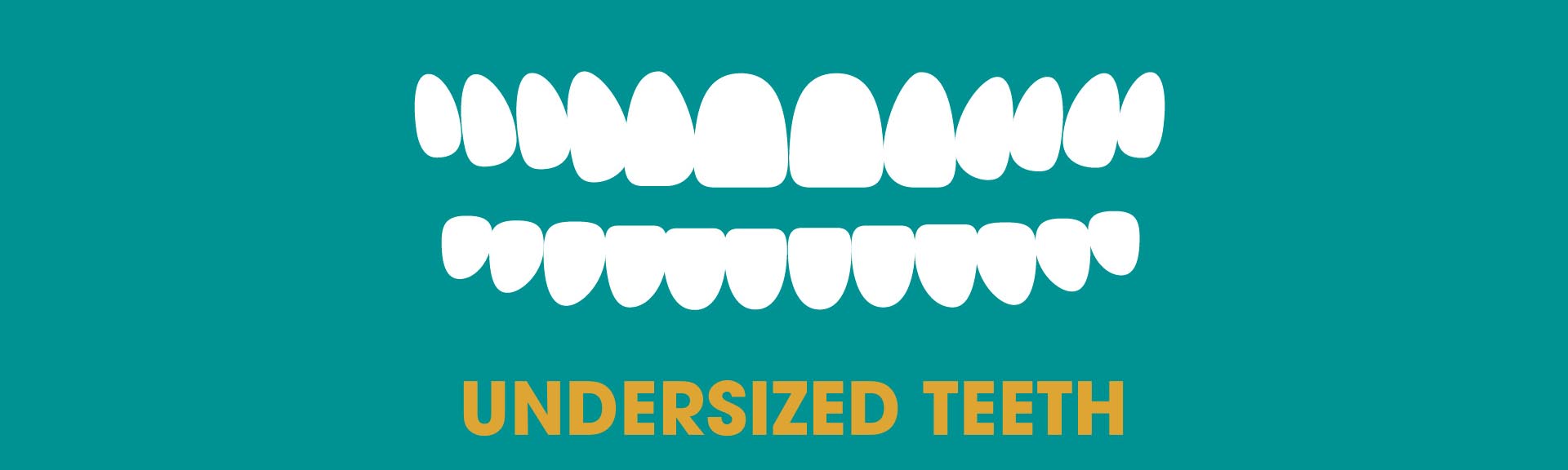 Designing Your Custom Smile with Dental Veneers - Avery Ranch Dental